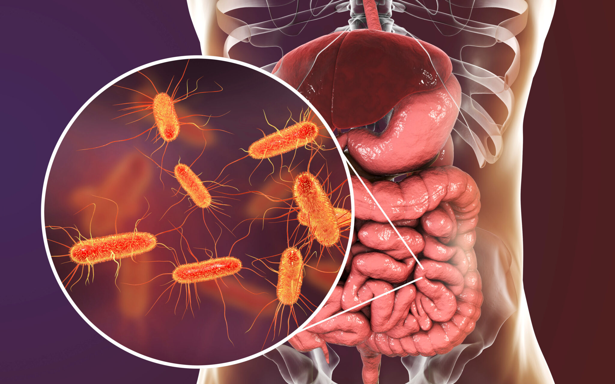 Scientists Have Finally Identified the Bacteria That Trigger Multiple ...