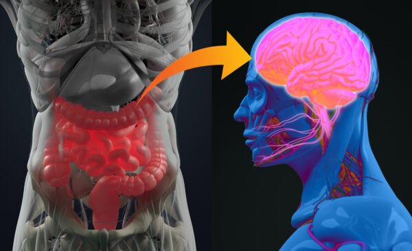 Scientists Have Finally Identified the Bacteria That Trigger Multiple ...