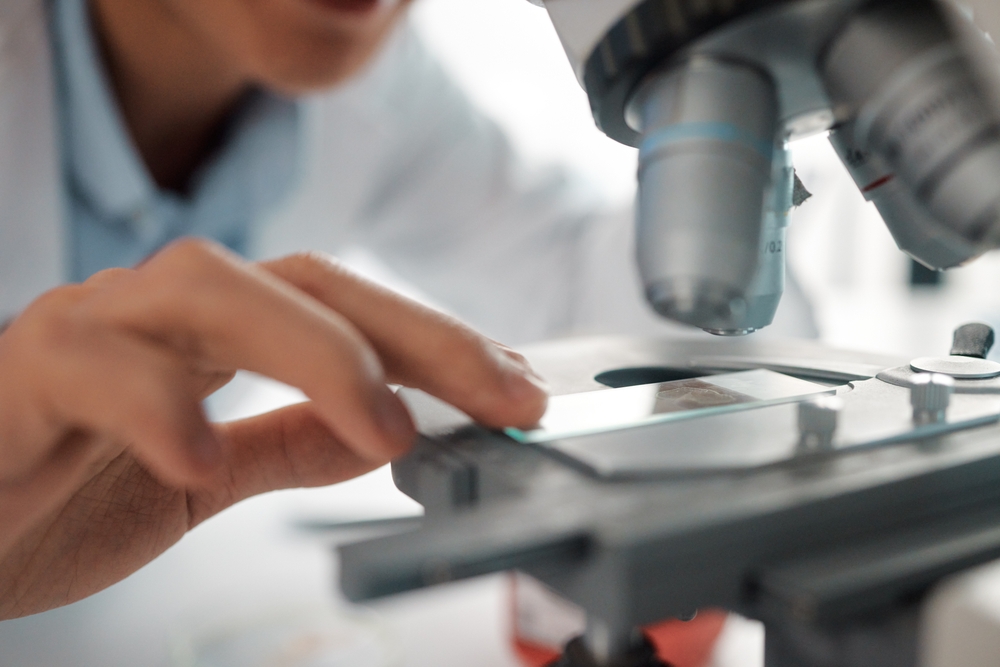 Scientists Discovered How to Kill Prostate Cancer Cells Without Harming ...