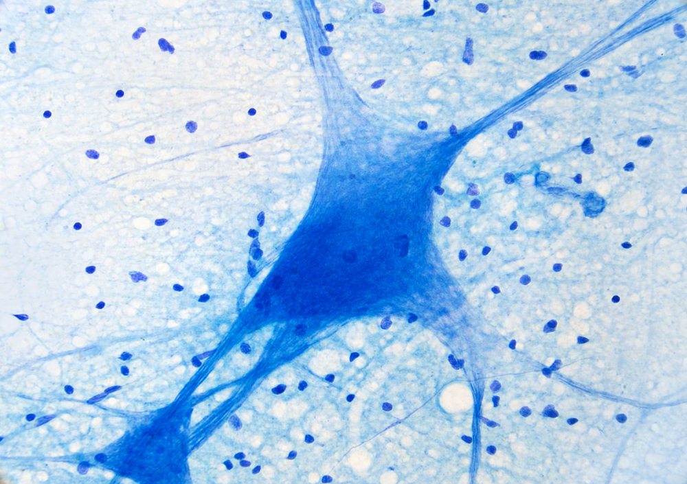 Autism and Schizophrenia May Begin Before Birth, a Study Finds